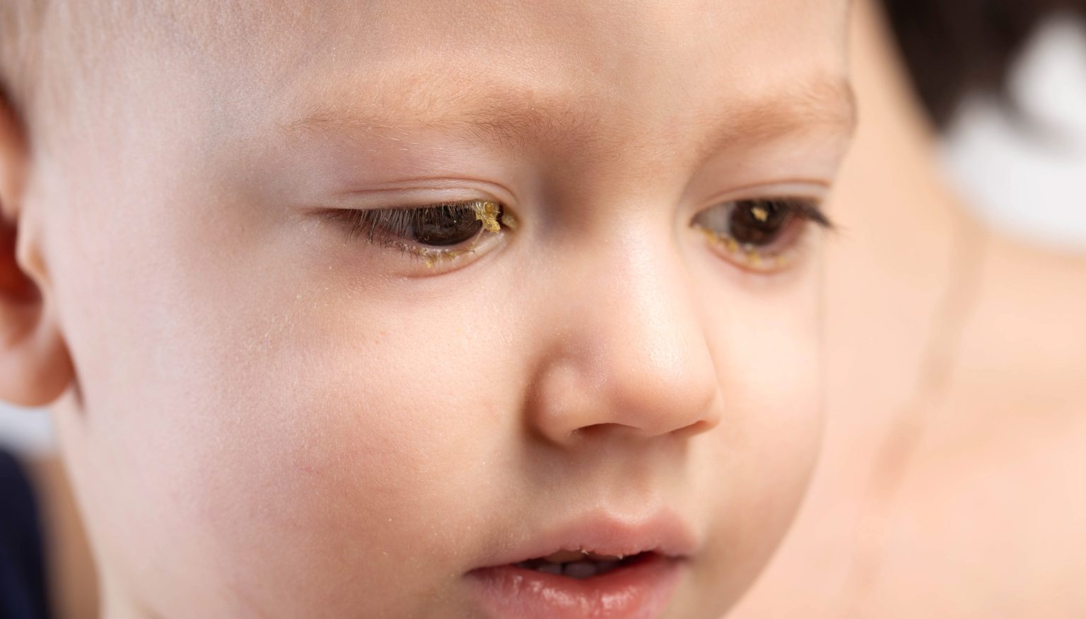 Gross Reason You Wake Up With Yellow Stuff In Your Eyes
