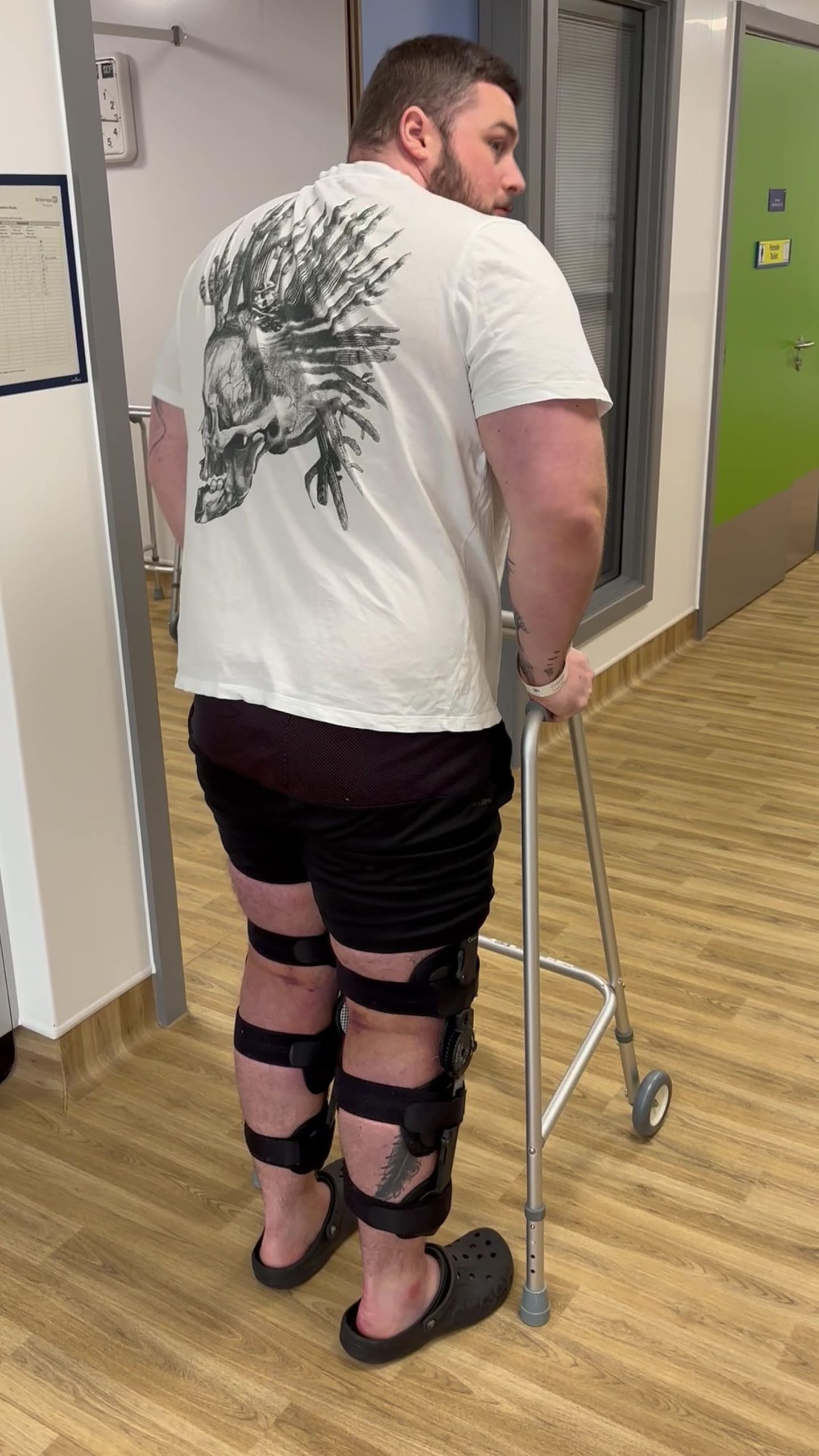 Strongman's Knees 'Shoot Into Thighs' As Tendons Snap In Graphic Footage