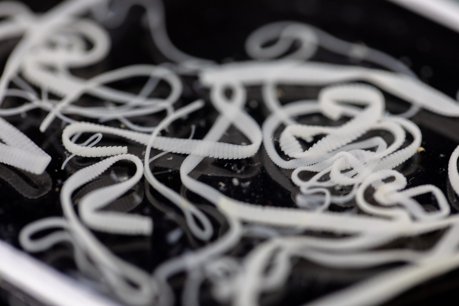 Man Develops Pork Worms In Brain From Unusual Cooking Habit