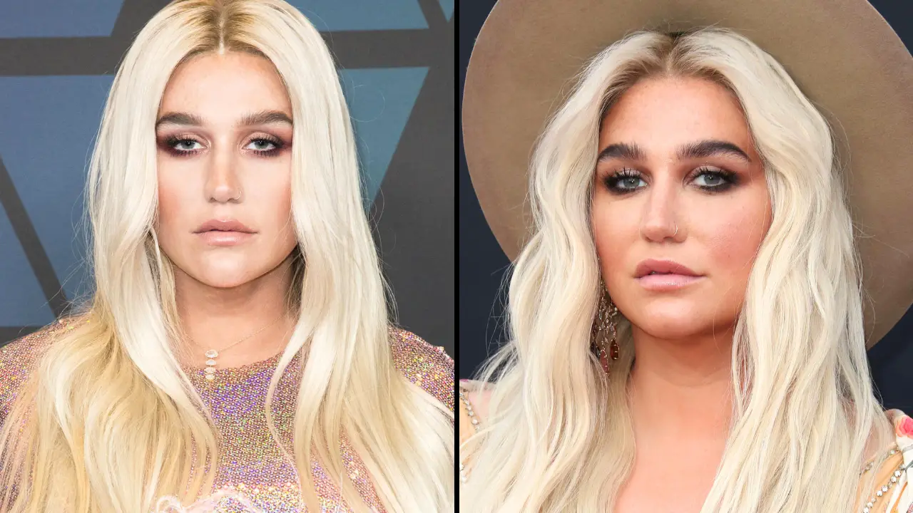 Kesha Has Come Out