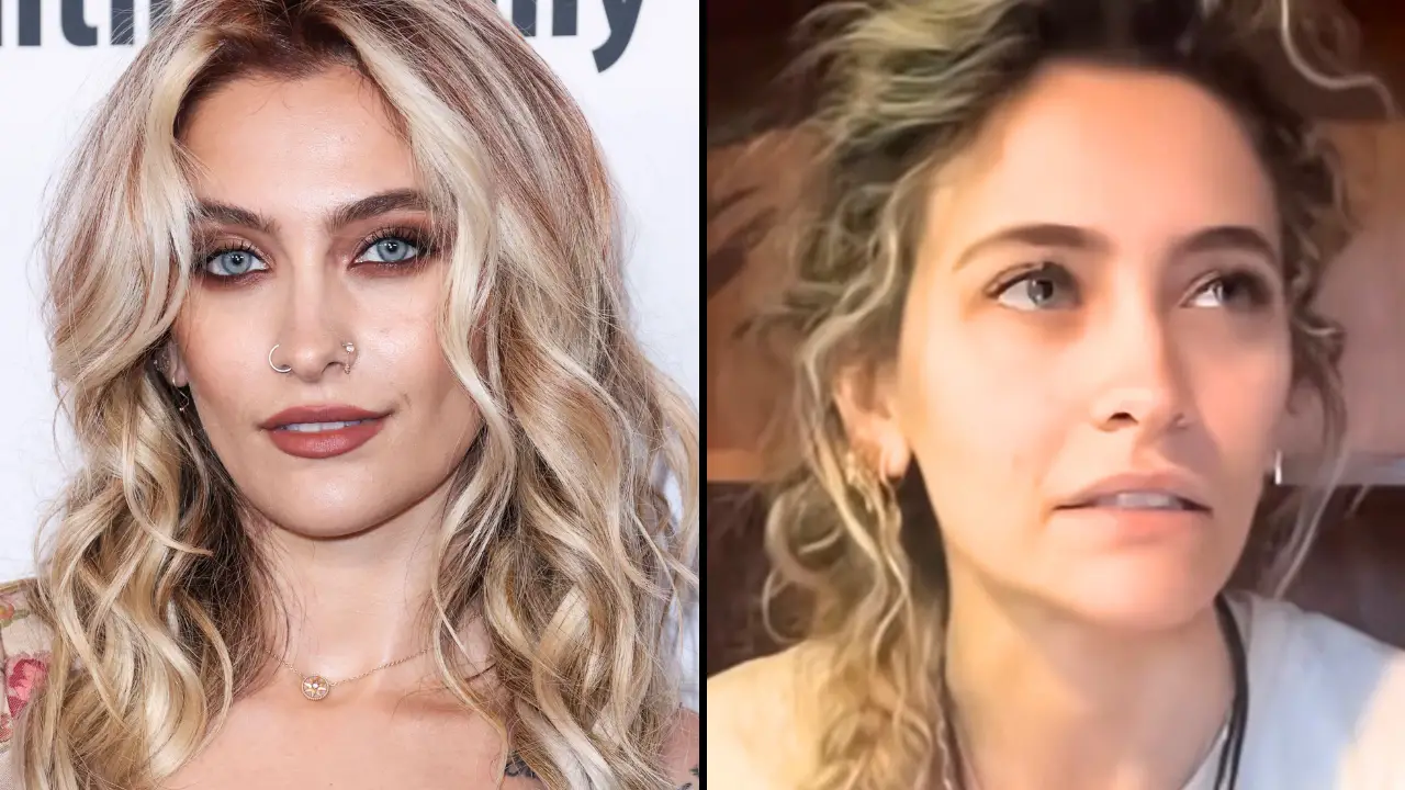 Paris Jackson Reveals Injuries From Drug Use In Graphic Video