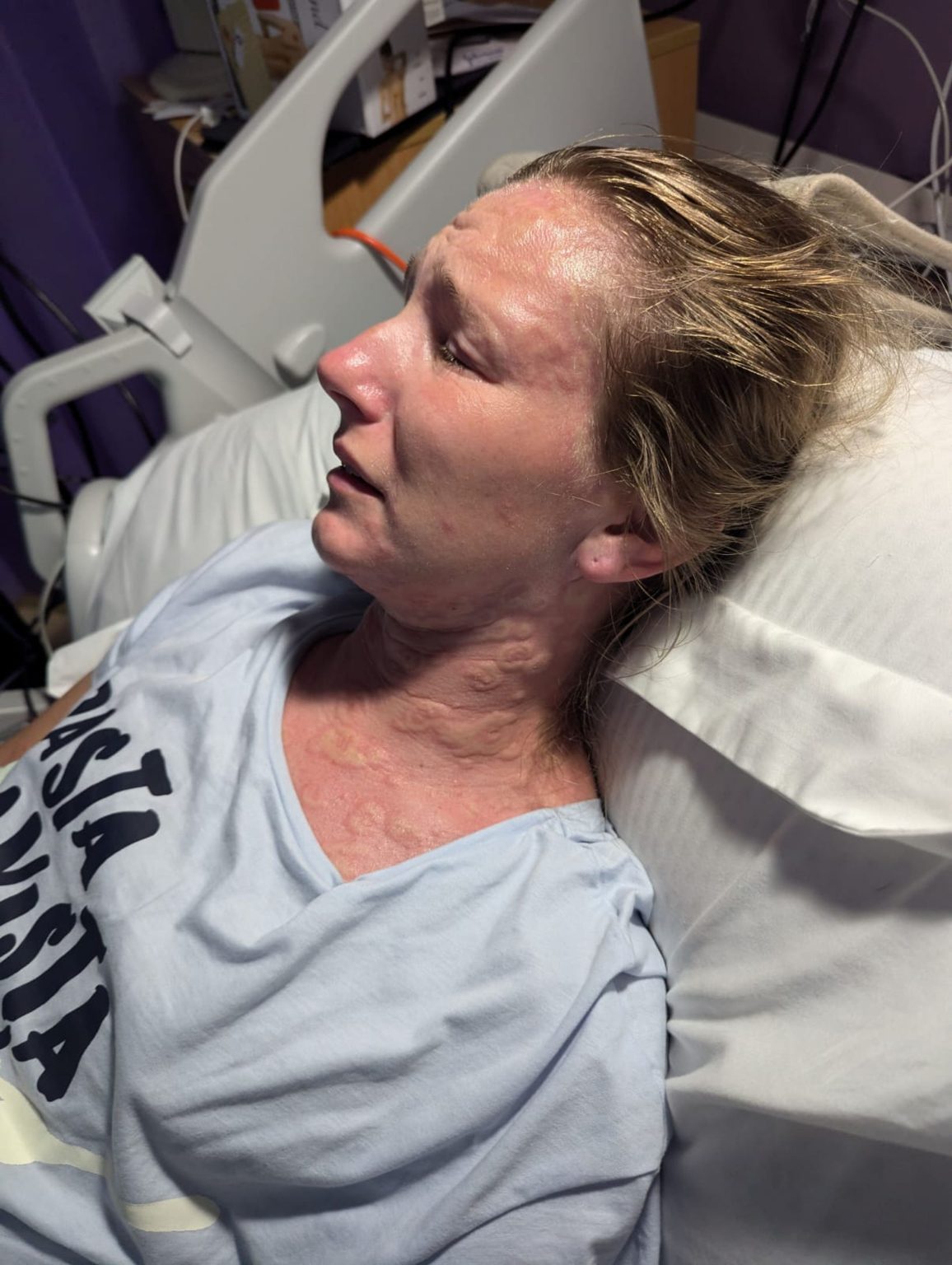 Mom Becomes Permanently Paralyzed While Doing The Laundry